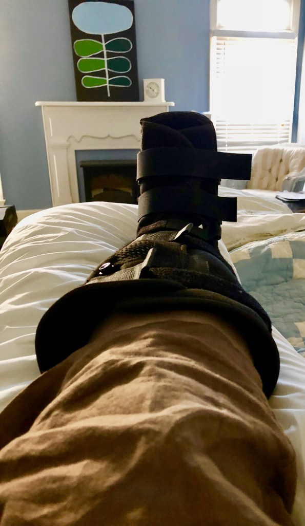 Life in the not so Fast Lane, or How do you mend a broken heart leg ...